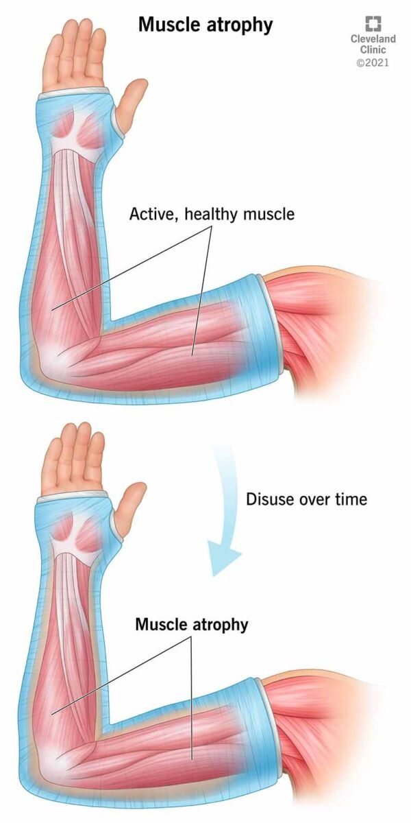Does Muscle Mass Affect Gfr Unveiling The Surprising Truth 0454